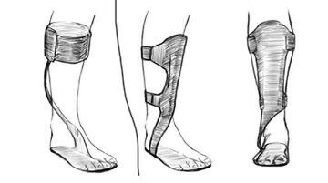 How Much Does An AFO (Ankle Foot Orthosis) Cost? – Rinella Prosthetics ...